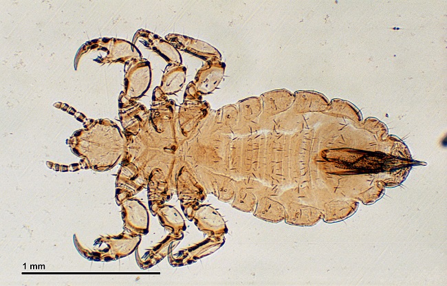 Diagnosis Pedikulosis - Alomedika