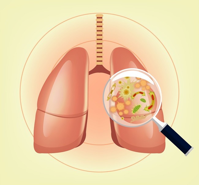 Efikasi Dan Keamanan Lefamulin Untuk Penatalaksanaan Pneumonia Komuniti efikasi-dan-keamanan-lefamulin-untuk-penatalaksanaan-pneumonia-komuniti
